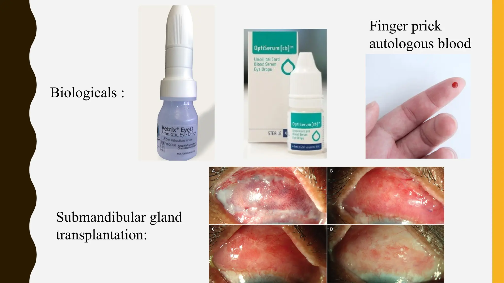 Dry Eye causes, aetiology, pathogenesis, treatment.pptx