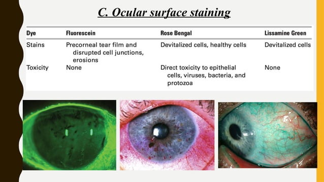 Dry Eye causes, aetiology, pathogenesis, treatment.pptx