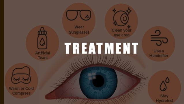 Dry Eye causes, aetiology, pathogenesis, treatment.pptx