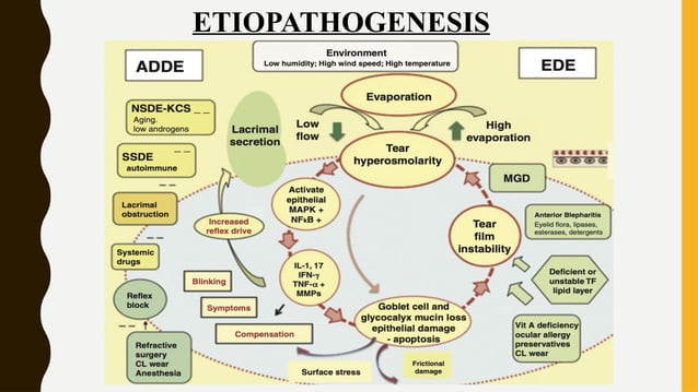 Dry Eye causes, aetiology, pathogenesis, treatment.pptx