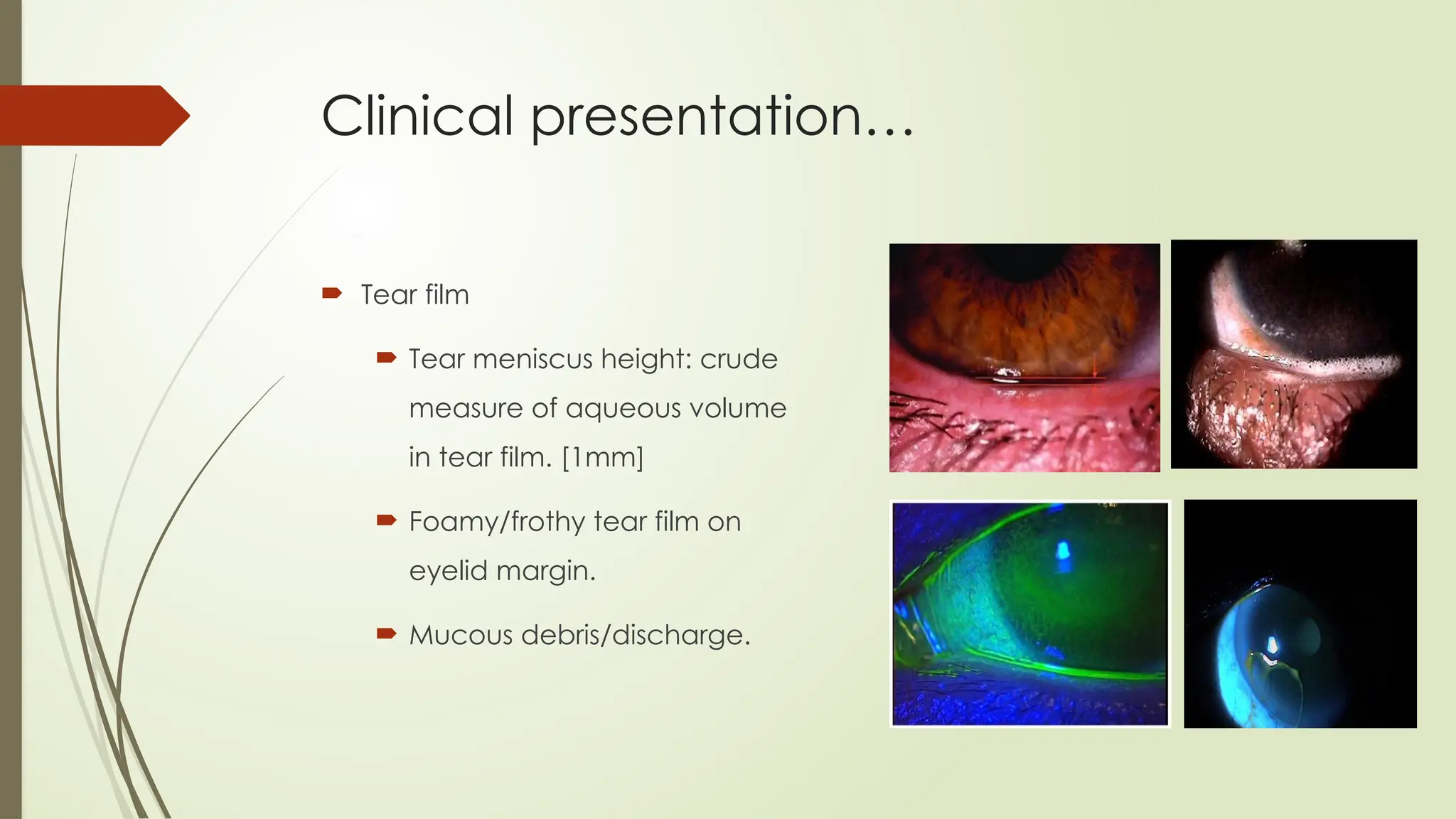 Investigations and Management of Dry Eye.pptx