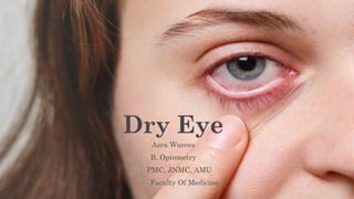 Dry Eye. A comprehensive overview on keratoconjunctivitis sicca | PPTX