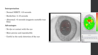 Dry Eye. A comprehensive overview on keratoconjunctivitis sicca | PPTX
