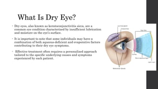 Dry Eye. A comprehensive overview on keratoconjunctivitis sicca | PPTX