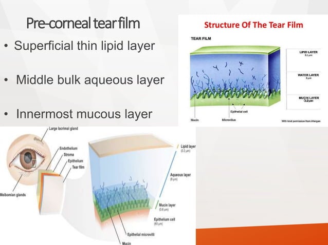 Dry eye sameer | PPT