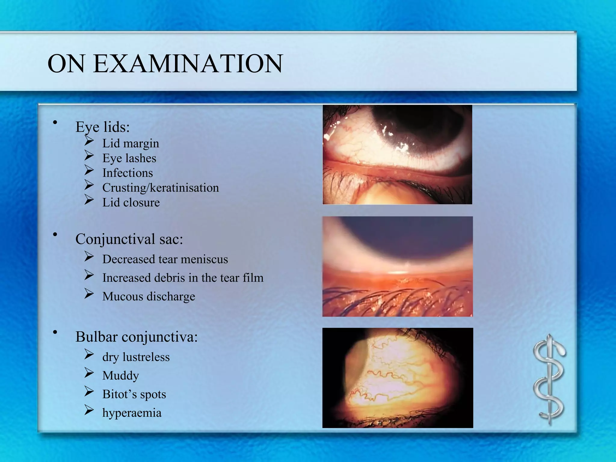 Dry eye | PPT