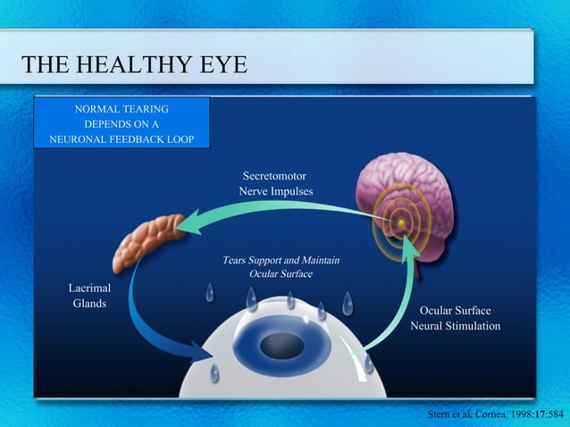 Dry eye | PPT | Eye and Vision Conditions | Diseases and Conditions