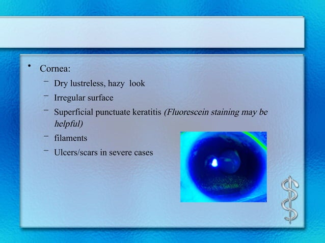Dry eye | PPT | Eye and Vision Conditions | Diseases and Conditions