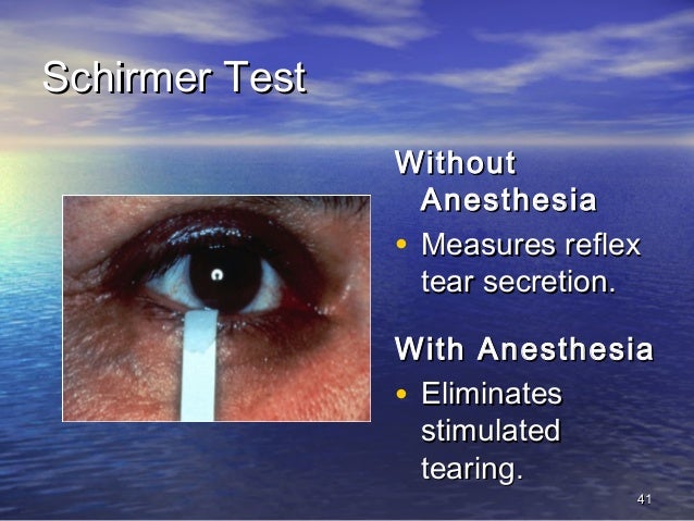 Dry eye: A Multifactorial Disease