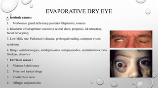 Dry eye disease | PPTX