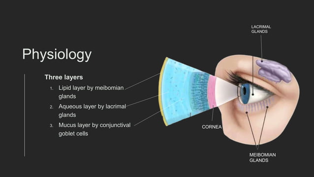 Dry eye disease- Etiology , Classification, Pathology, Staging ...