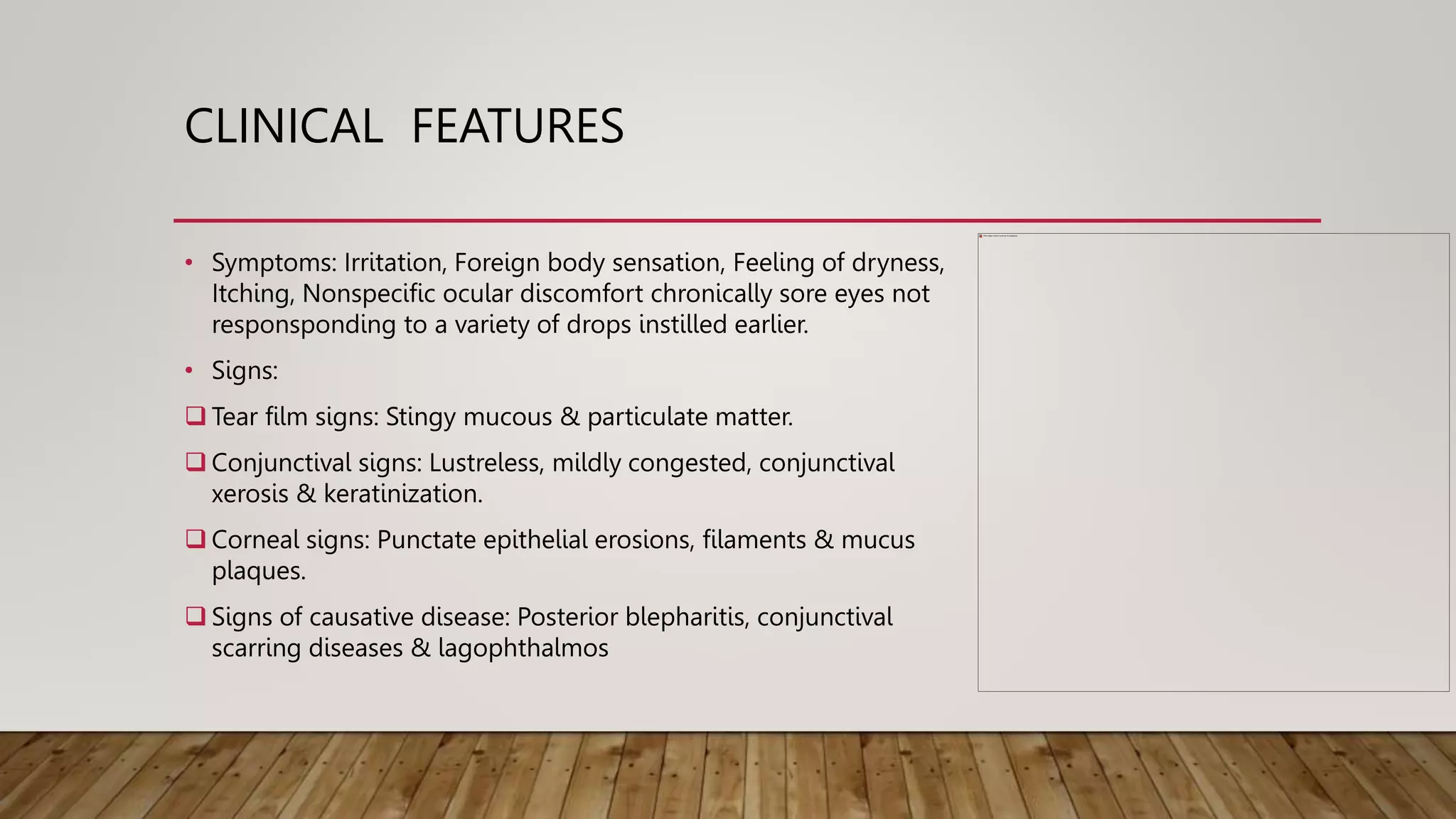 Dry eye & epiphora.pptx