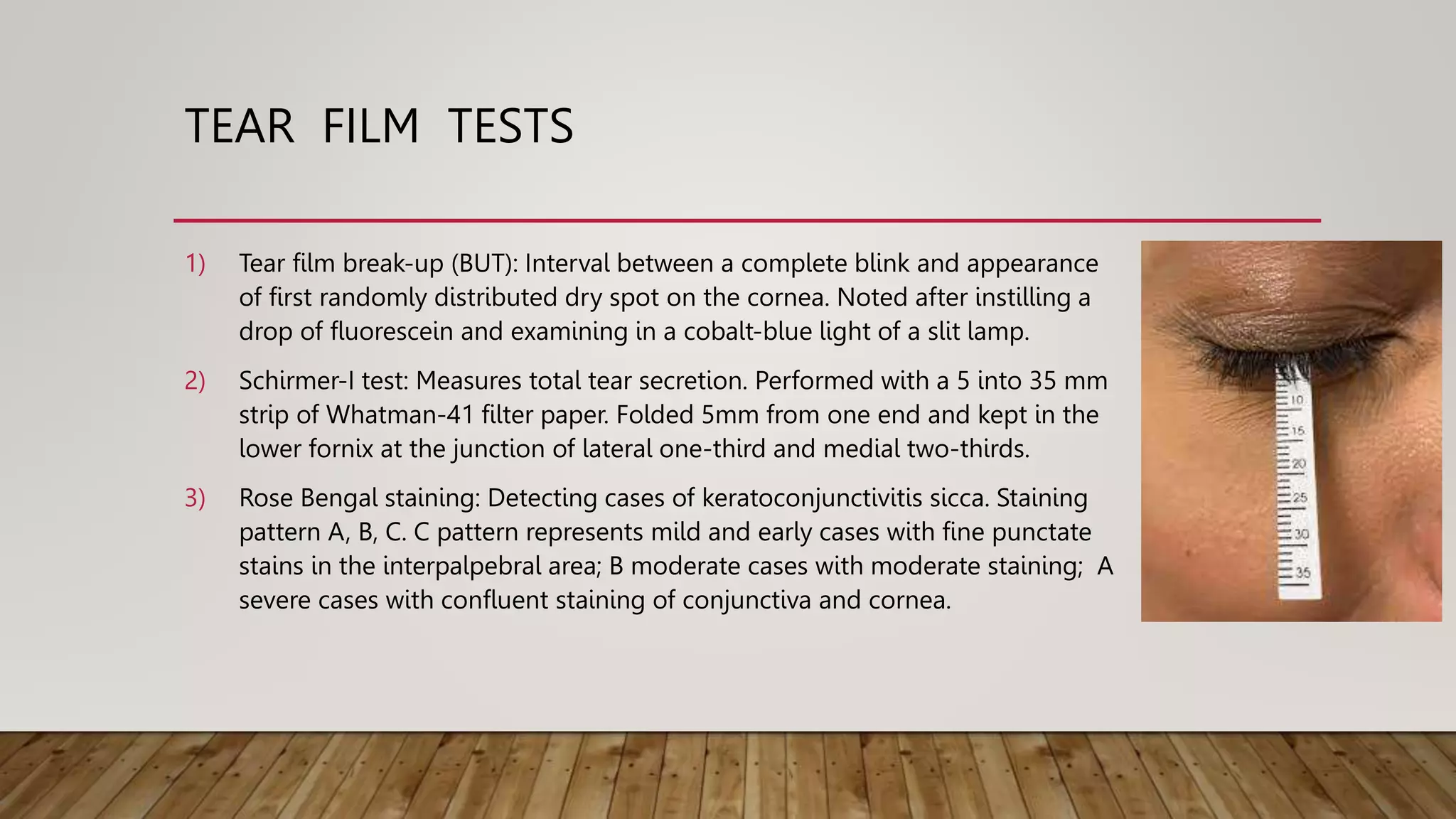Dry eye & epiphora.pptx