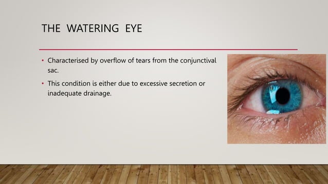 Dry eye & epiphora.pptx | Eye and Vision Conditions | Diseases and ...