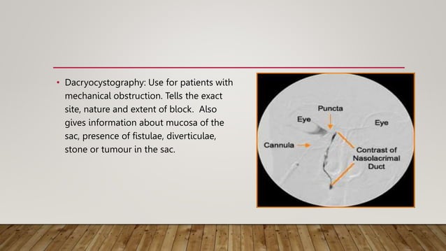 Dry eye & epiphora.pptx | Eye and Vision Conditions | Diseases and ...