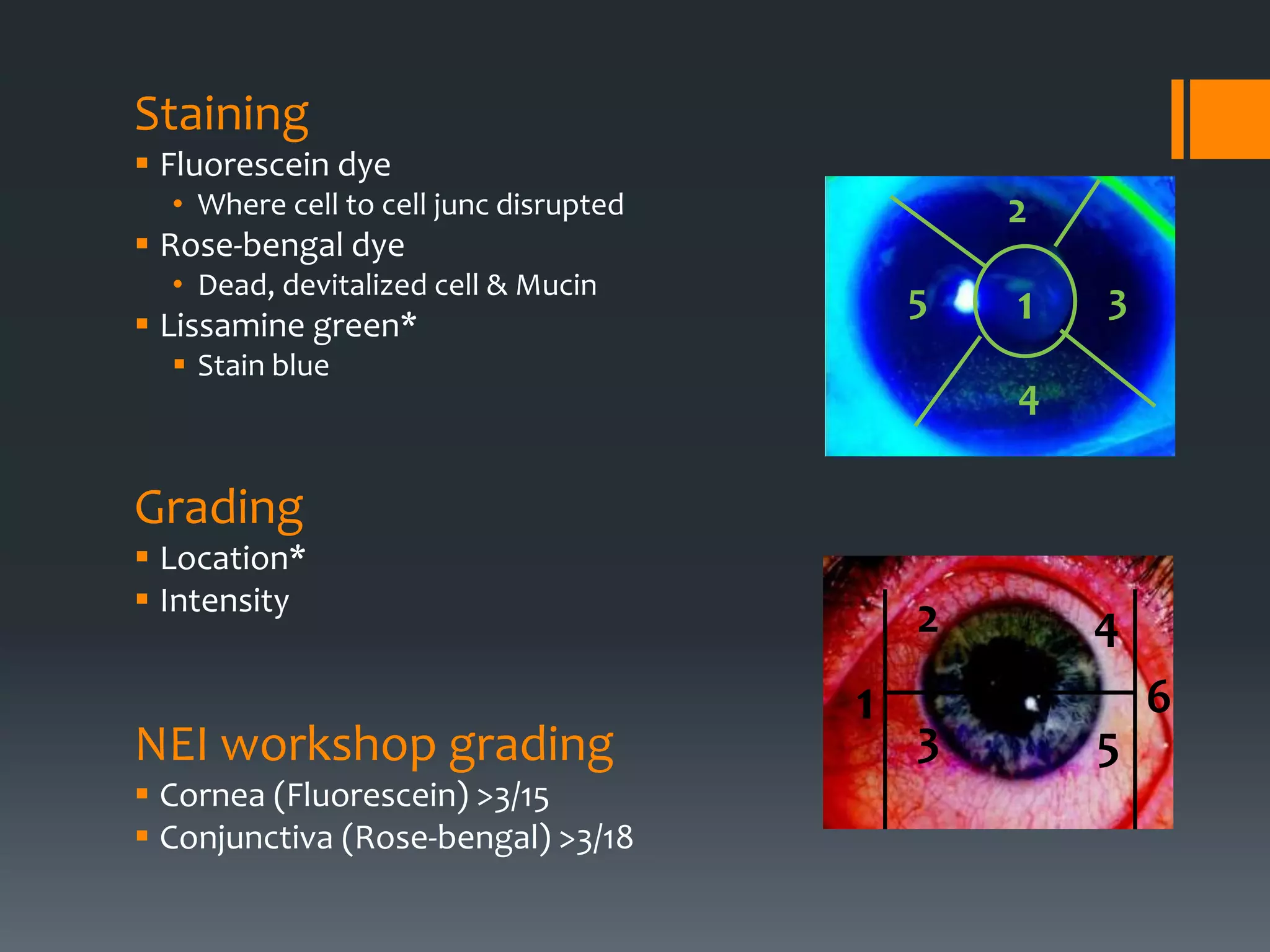 Dry eye evaluation and mx ppt | PPTX