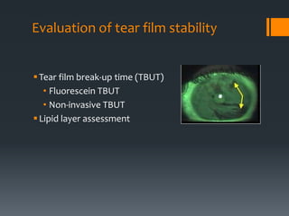 Dry eye evaluation and mx ppt | PPTX