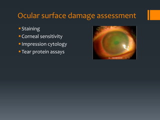 Dry eye evaluation and mx ppt | PPTX