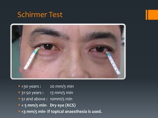 Dry eye evaluation and mx ppt | PPTX