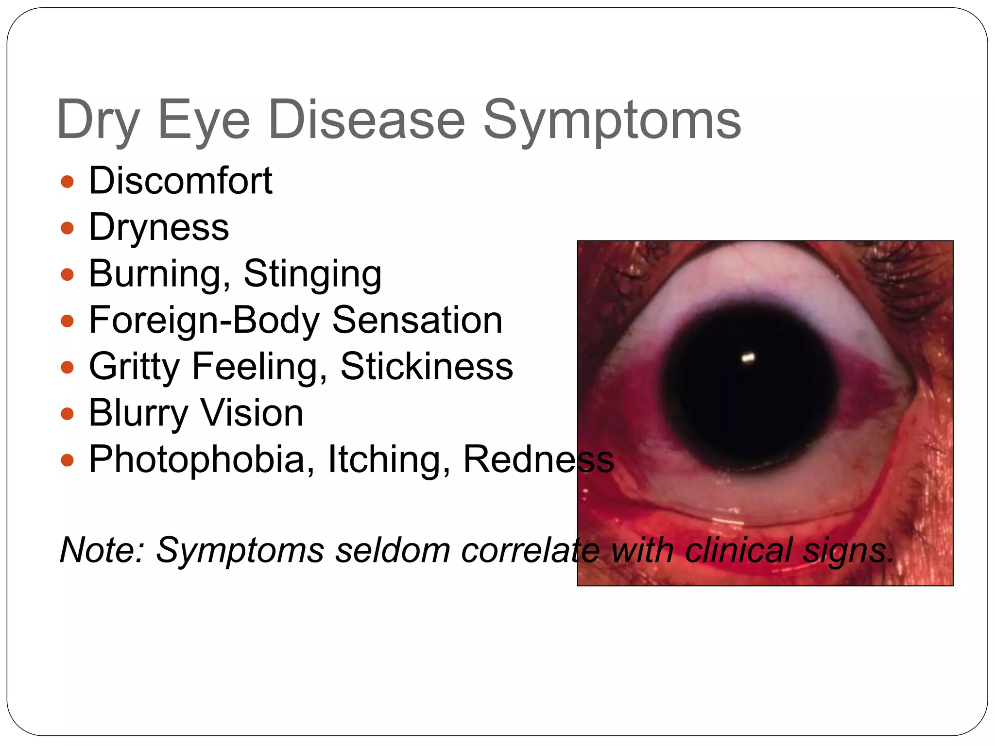 Dry Eye Disease | PPTX