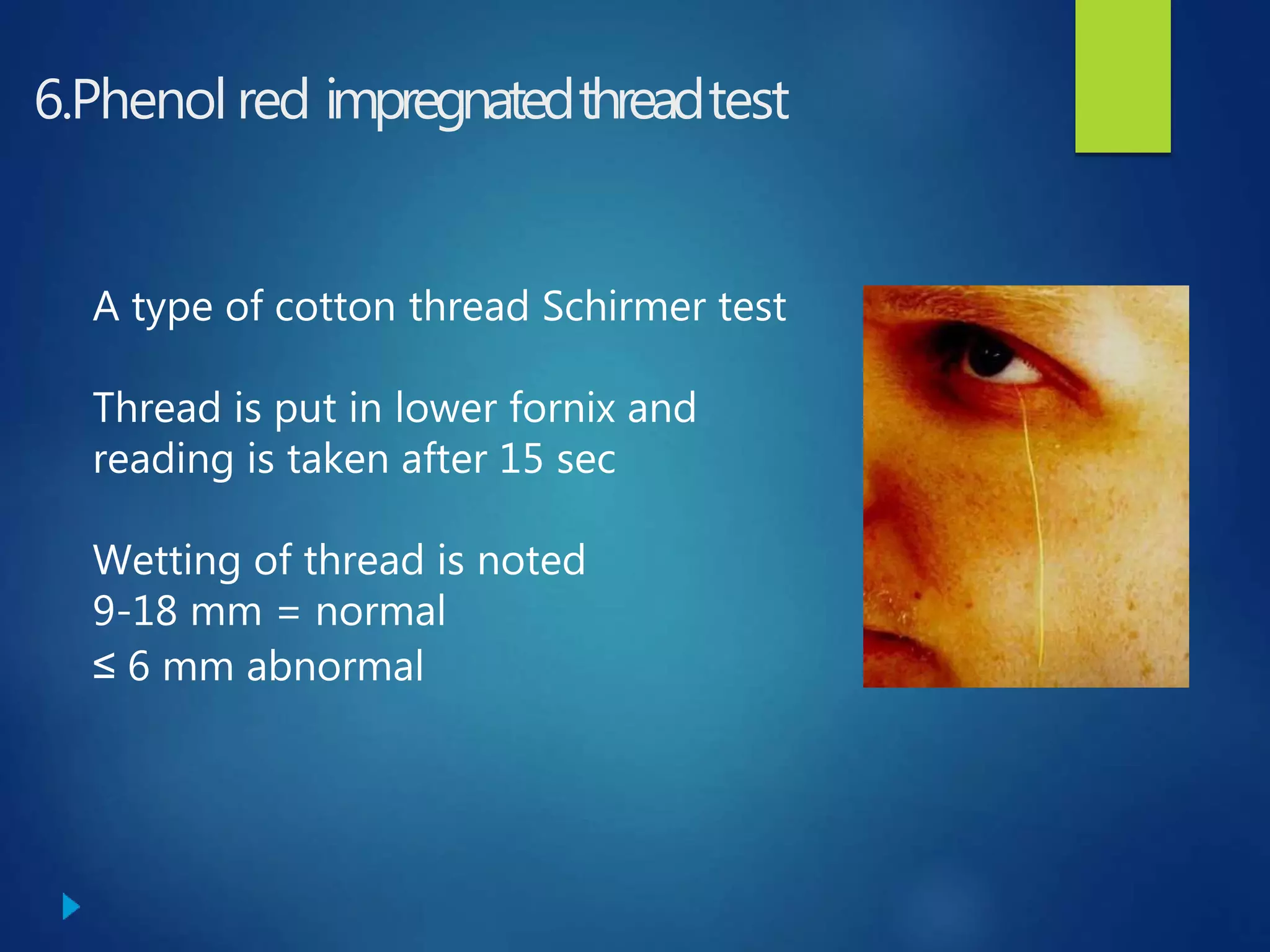 Dry eye diagnosis and management | PPTX