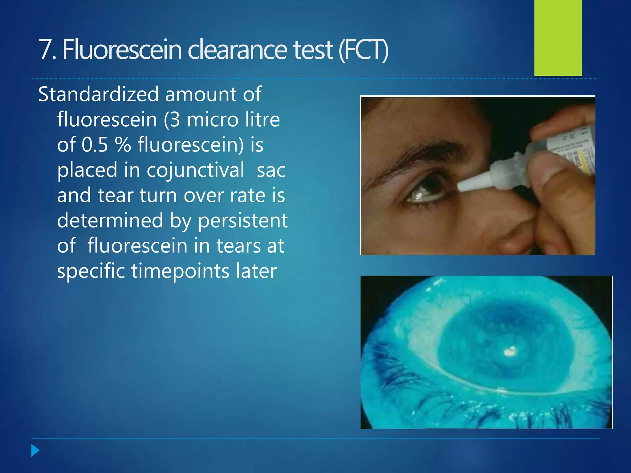 Dry eye diagnosis and management | PPTX