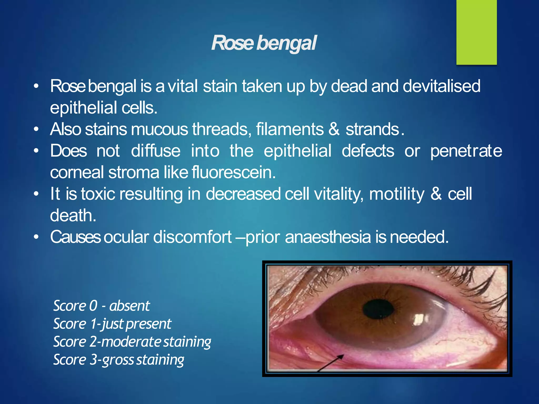 Dry eye diagnosis and management | PPTX