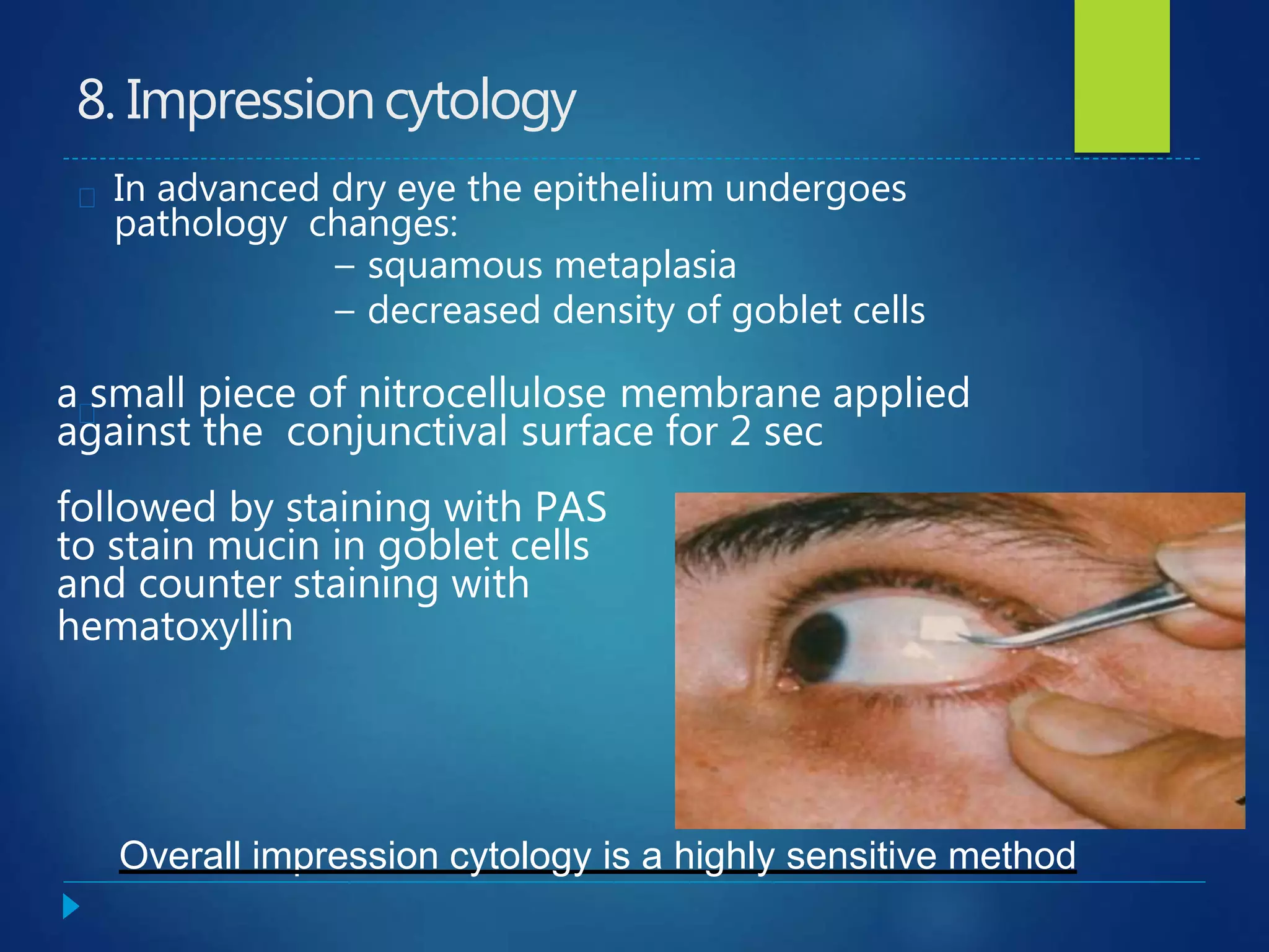 Dry eye diagnosis and management | PPTX