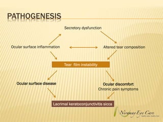 Dry Eye | PPTX