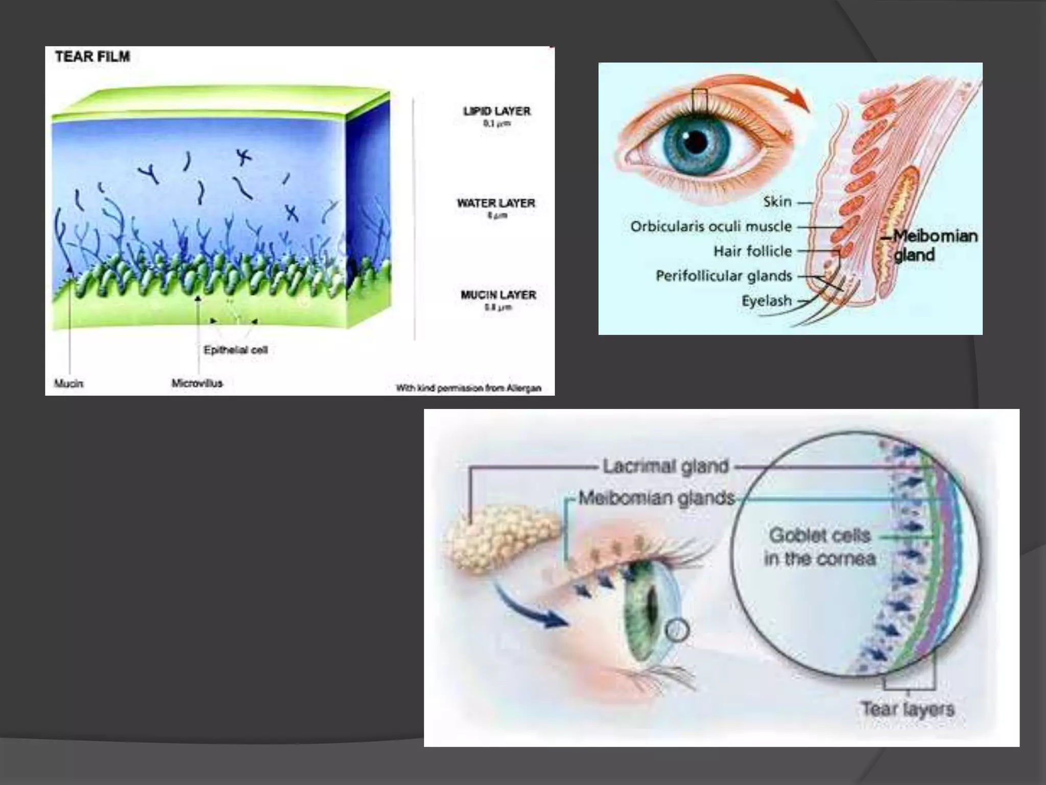 Dry eye ppt | PPT