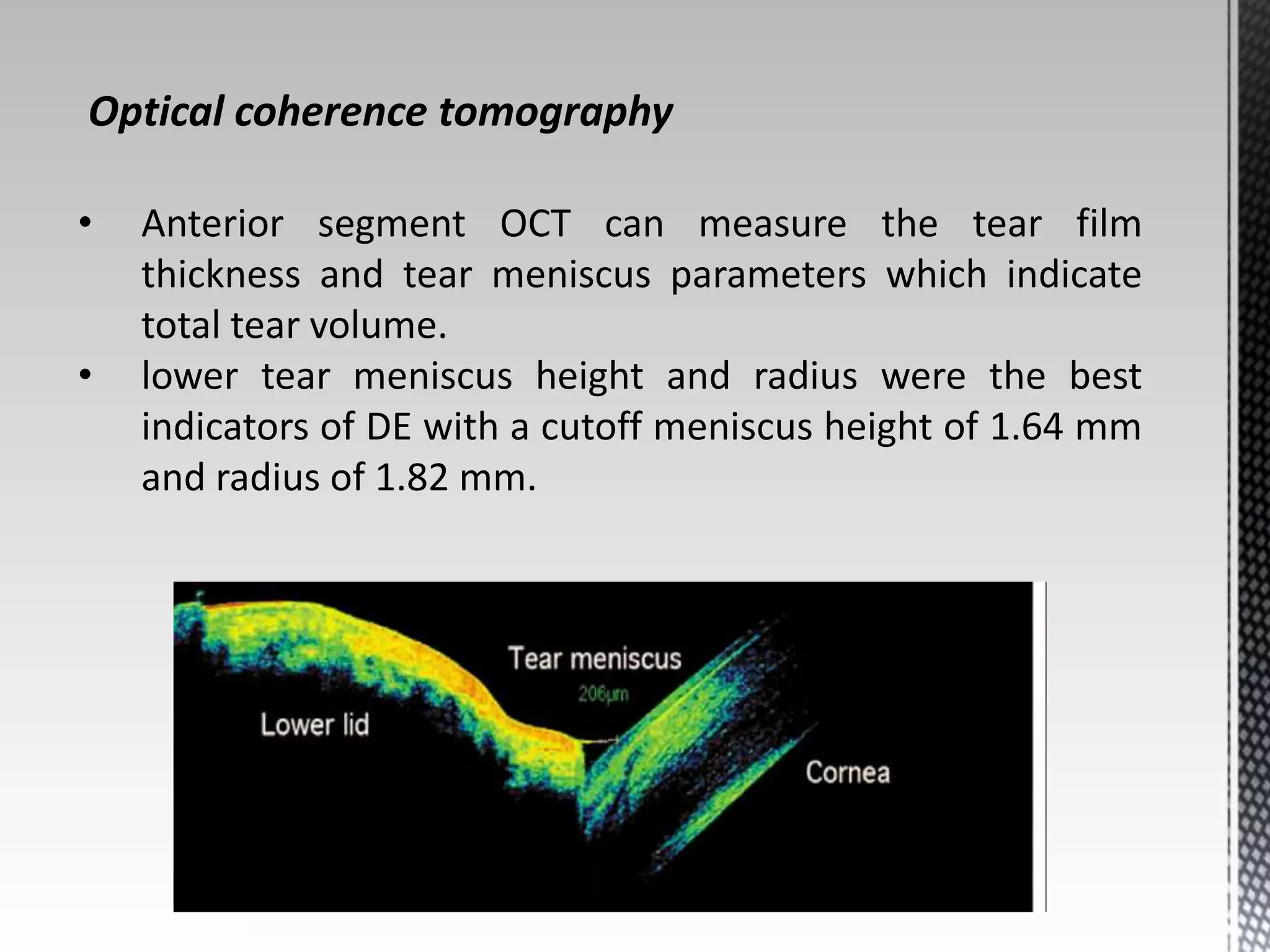Dry eye ppt by dr dildar | PPTX