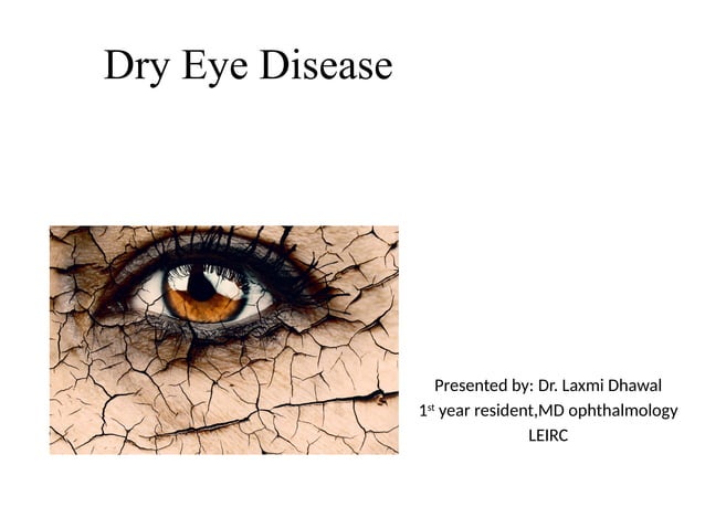 Dry_Eye_Presentation_Final[1].pptx...... | PPTX