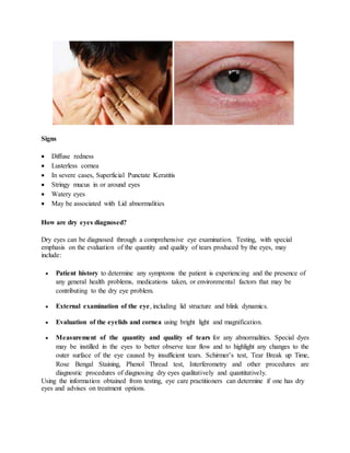 Dry eyes | PDF