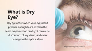 Understanding Dry Eyes: Causes, Symptoms & Treatment Options | PPTX