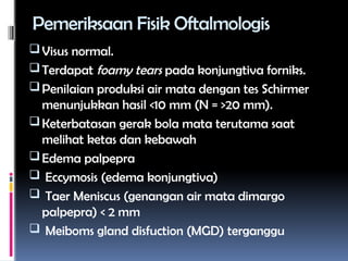 DRY EYE Syndrome.pptxxxxxxxxxxxxxxxxxxxx | PPTX