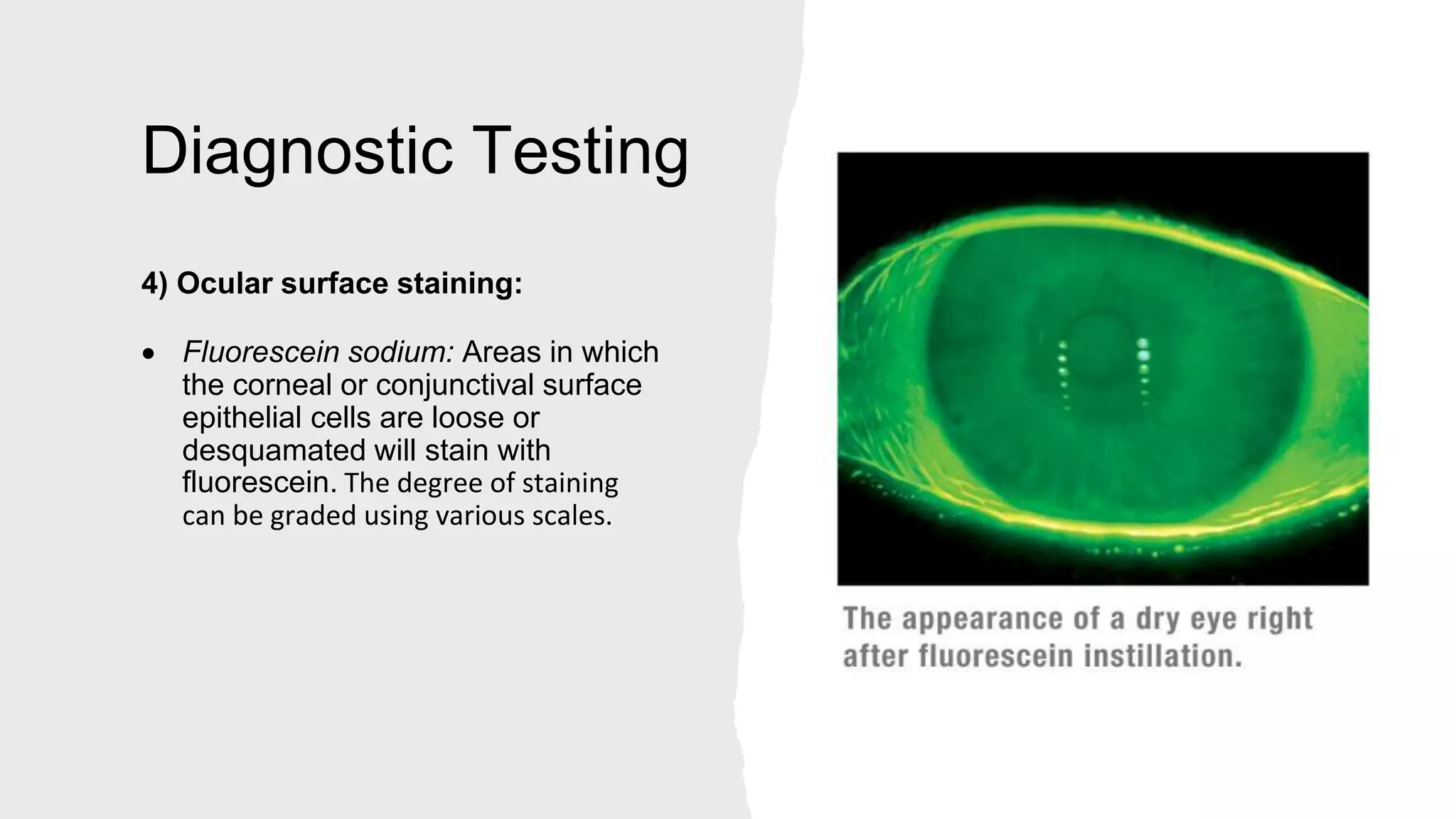 Dry Eye Syndrome 33.pptx