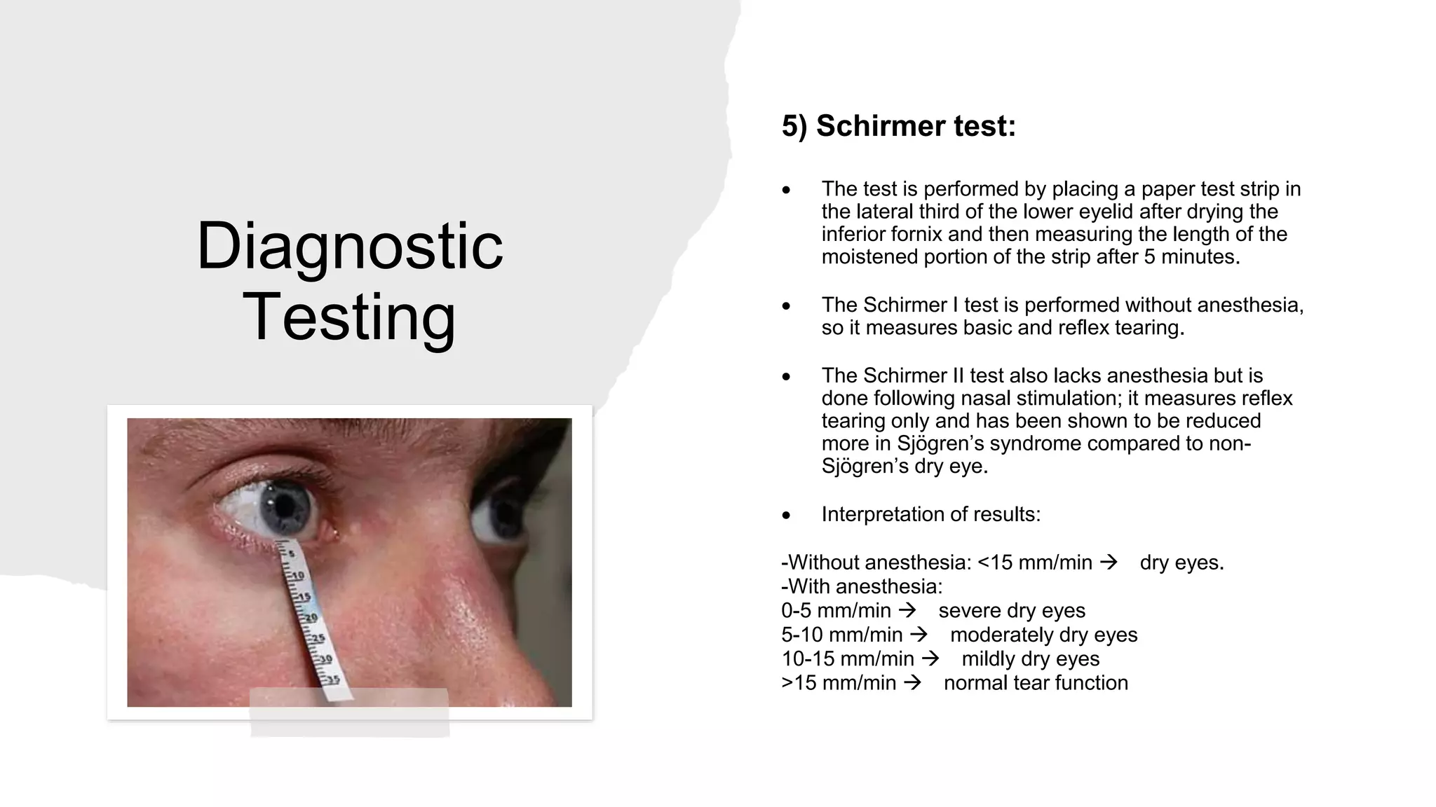 Dry Eye Syndrome 33.pptx
