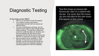 Dry Eye Syndrome 33.pptx
