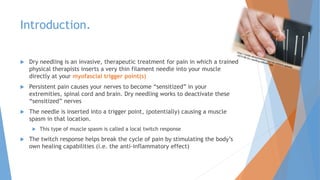 Dry Needling Research | PPTX
