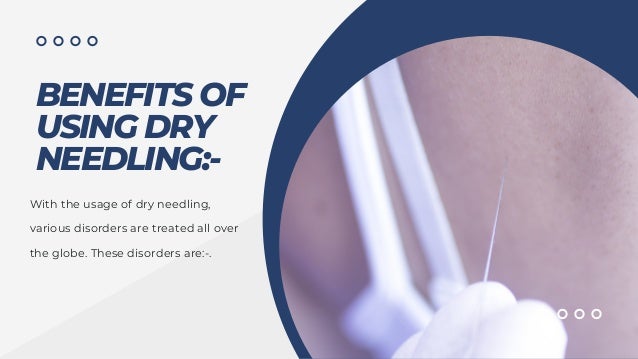 Dry Needling Therapy Reasons and Benefits.pdf