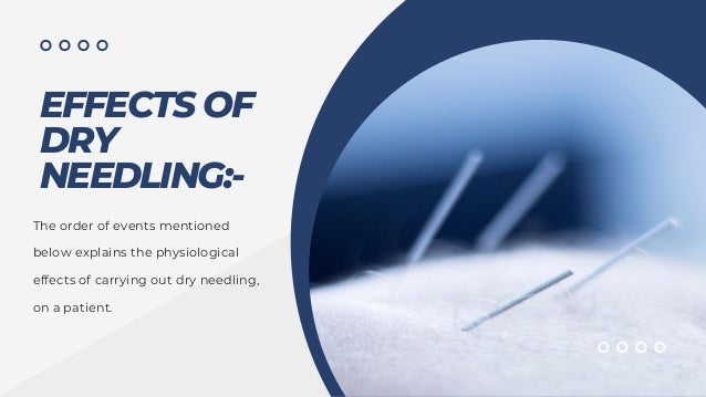 Dry Needling Therapy Reasons and Benefits.pdf