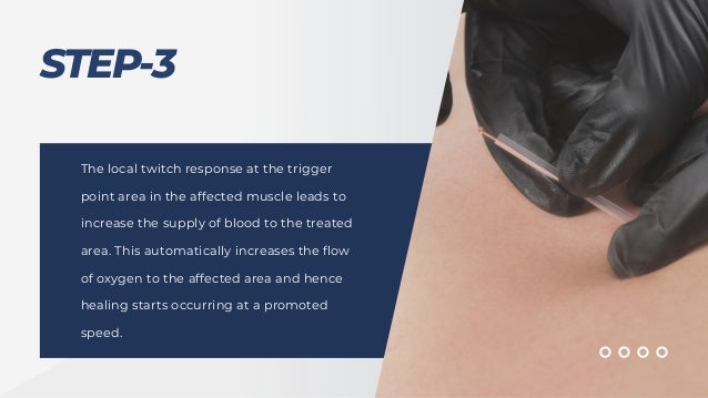 Dry Needling Therapy Reasons and Benefits.pdf