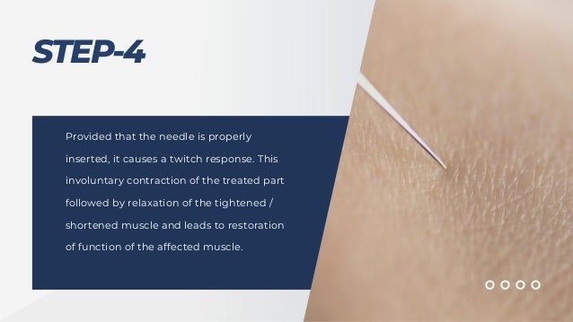 Dry Needling Therapy Reasons and Benefits.pdf