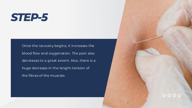 Dry Needling Therapy Reasons and Benefits.pdf