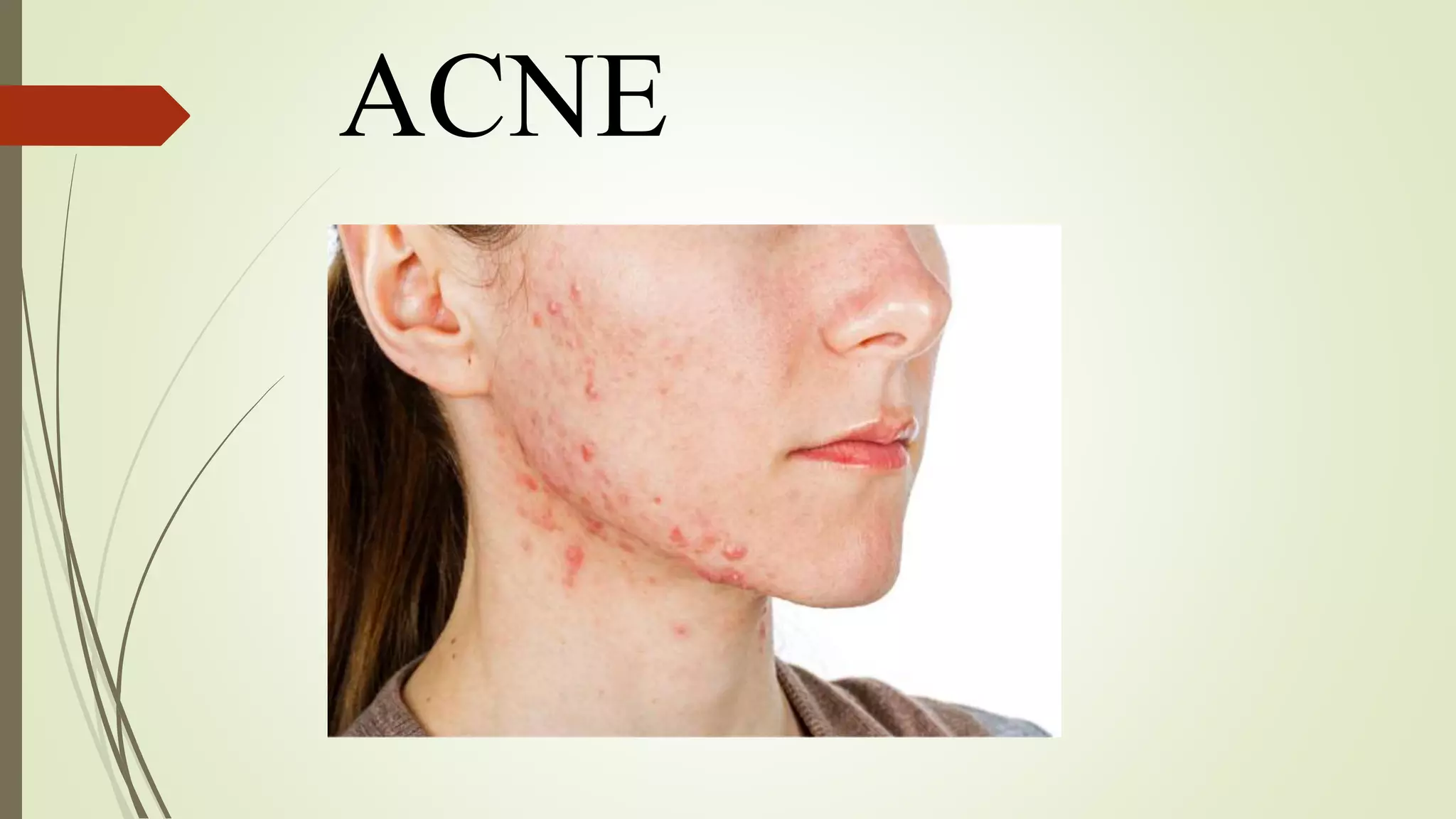 Dry skin, acne, sun protection address | PPT