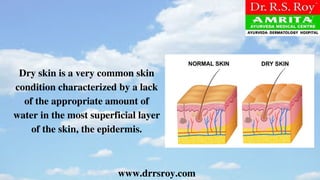 Dry Skin Ayurvedic Treatment In Kerala | Skin Disease Treatment In ...