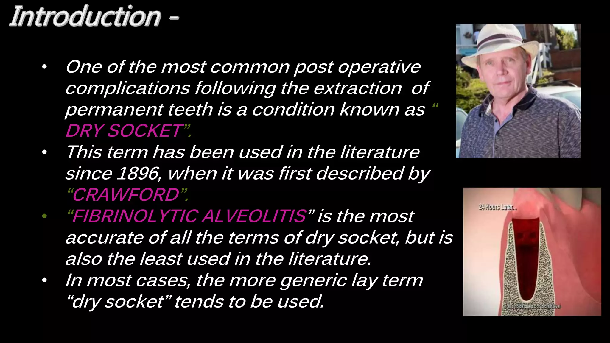 Dry socket | PPTX
