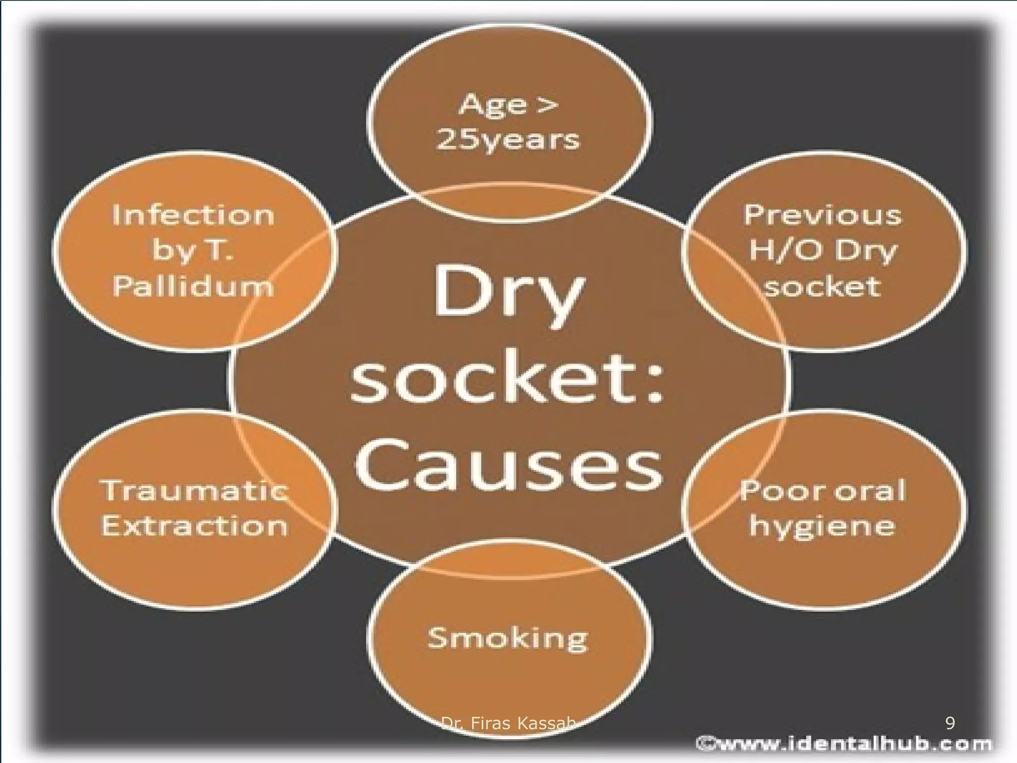 Dry socket | PDF