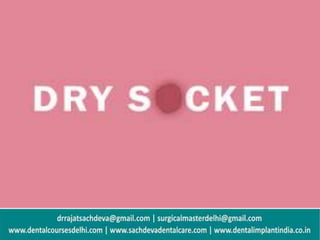 Dry socket | PPTX