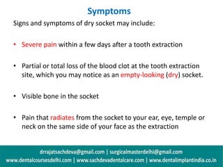 Dry socket | PPTX